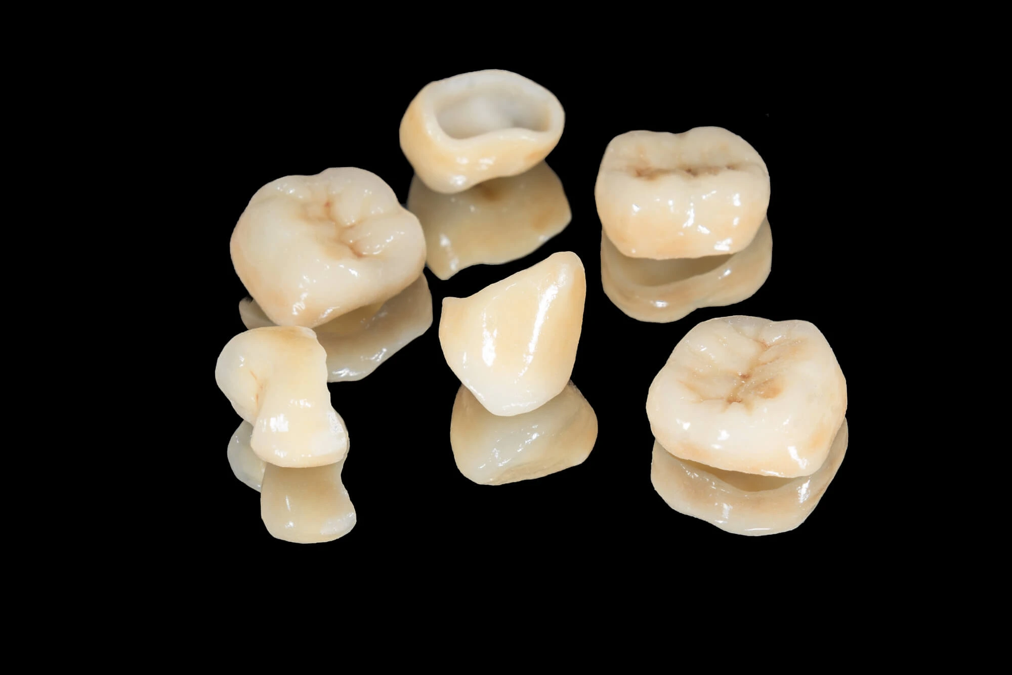 What Are the Best Materials for Dental Crowns? - MIGUEL FERRER, DDS