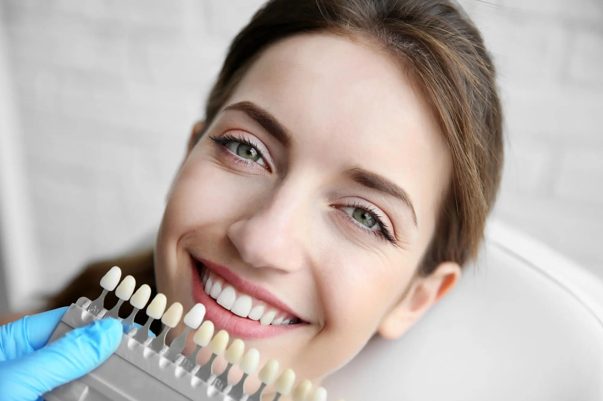 What's the Ideal Frequency for Touch-Ups After Whitening? - MIGUEL ...